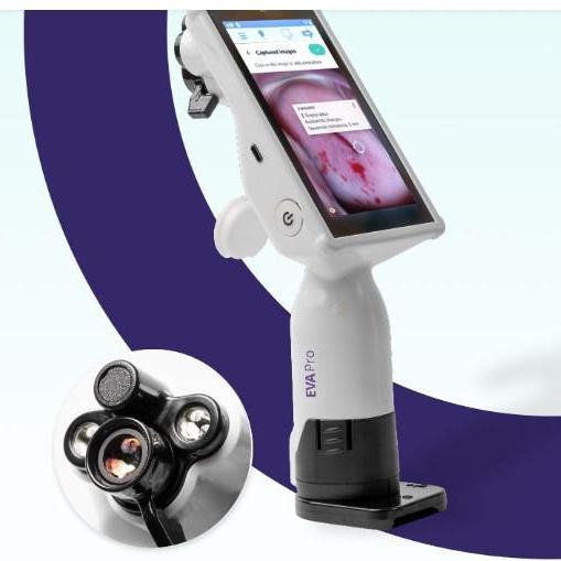 EVA Pro Digital Colposcope | LabMart Limited